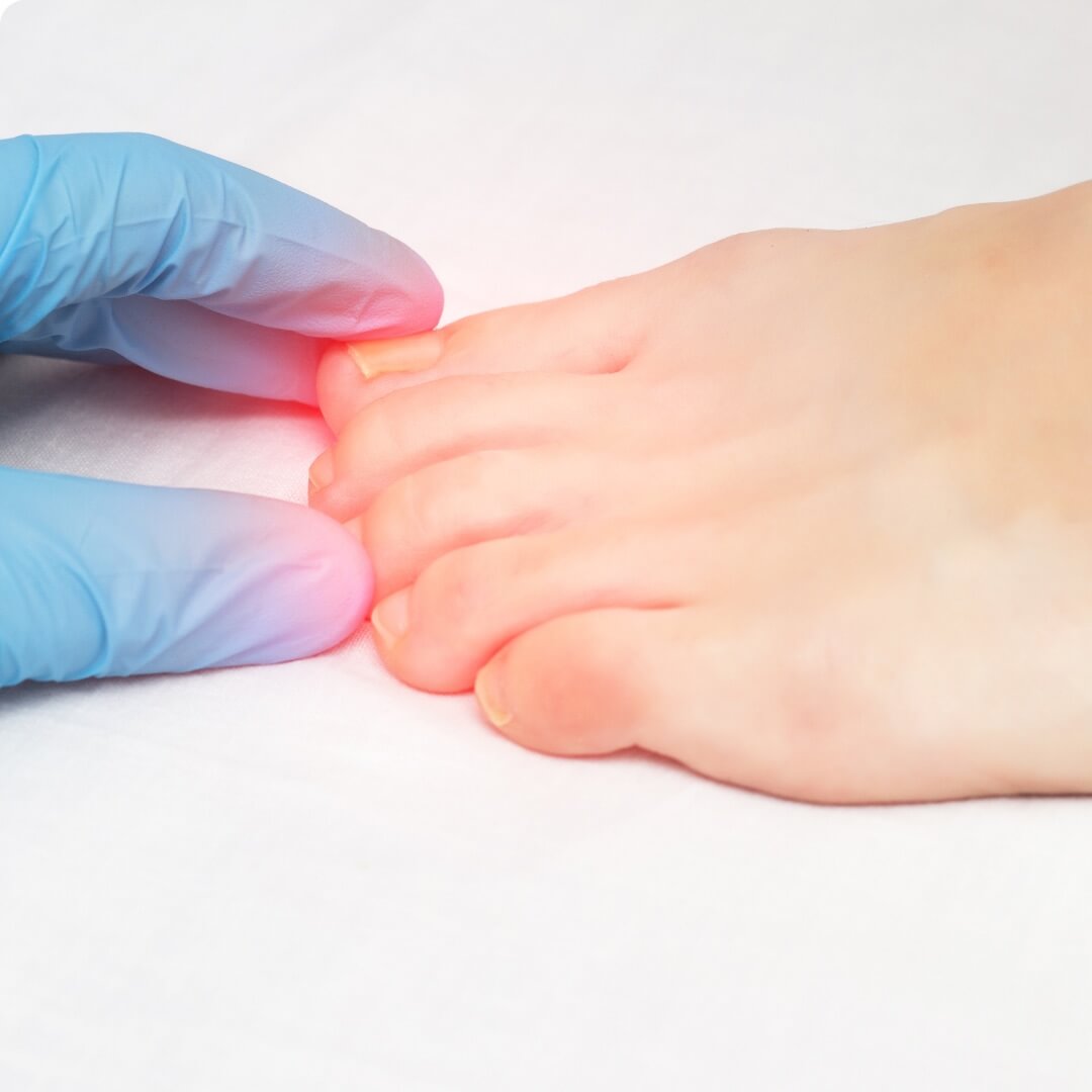 Foot Health
